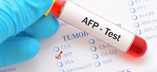 Alpha-Fetoprotein (AFP) Test: Procedure, Interpretation, Results