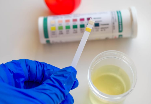 Understanding Acetone in Urine: Symptoms, Causes, and Treatment Options